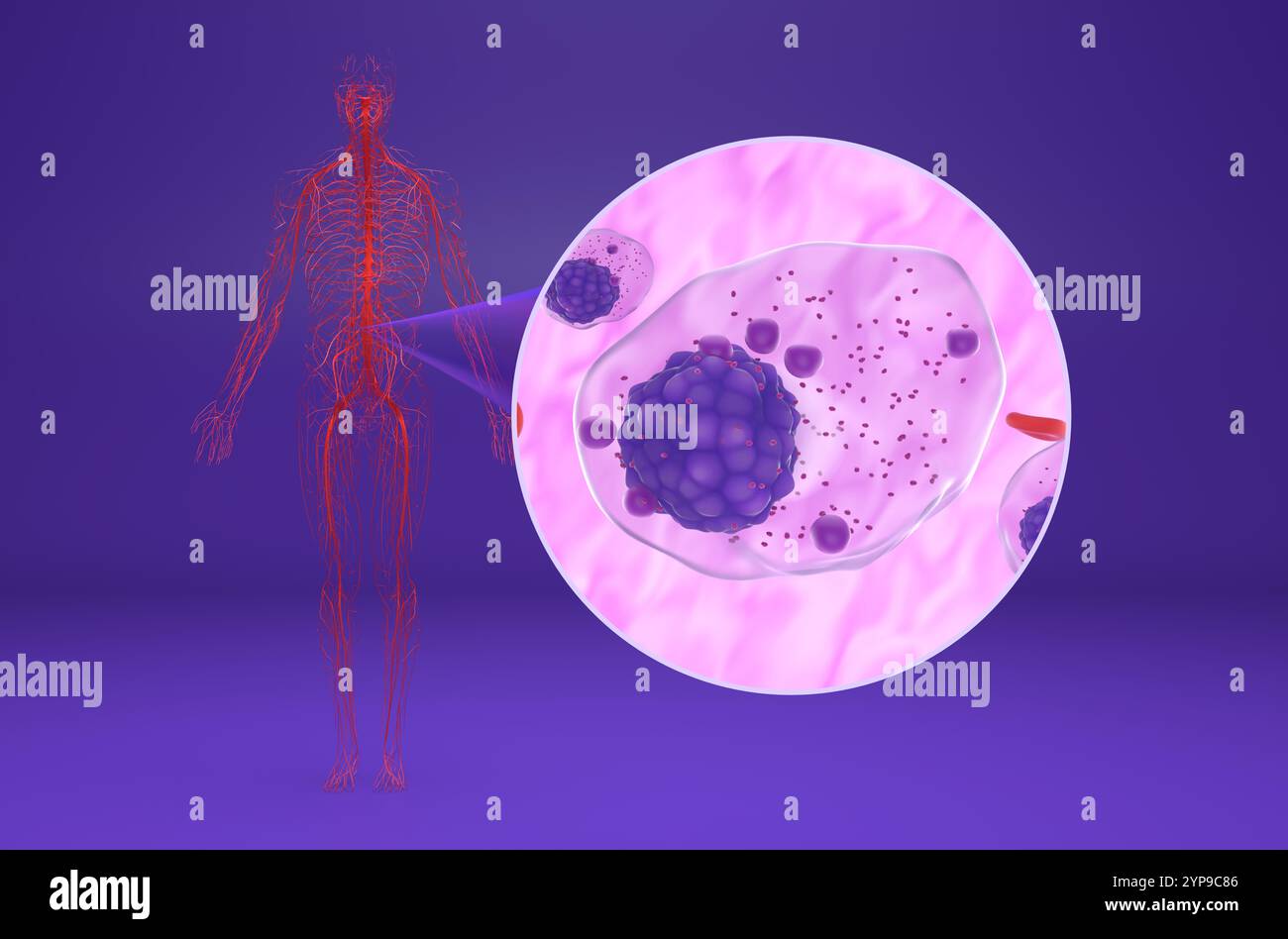 Multiple myeloma (MM) cells in the blood flow - isometric view 3d ...