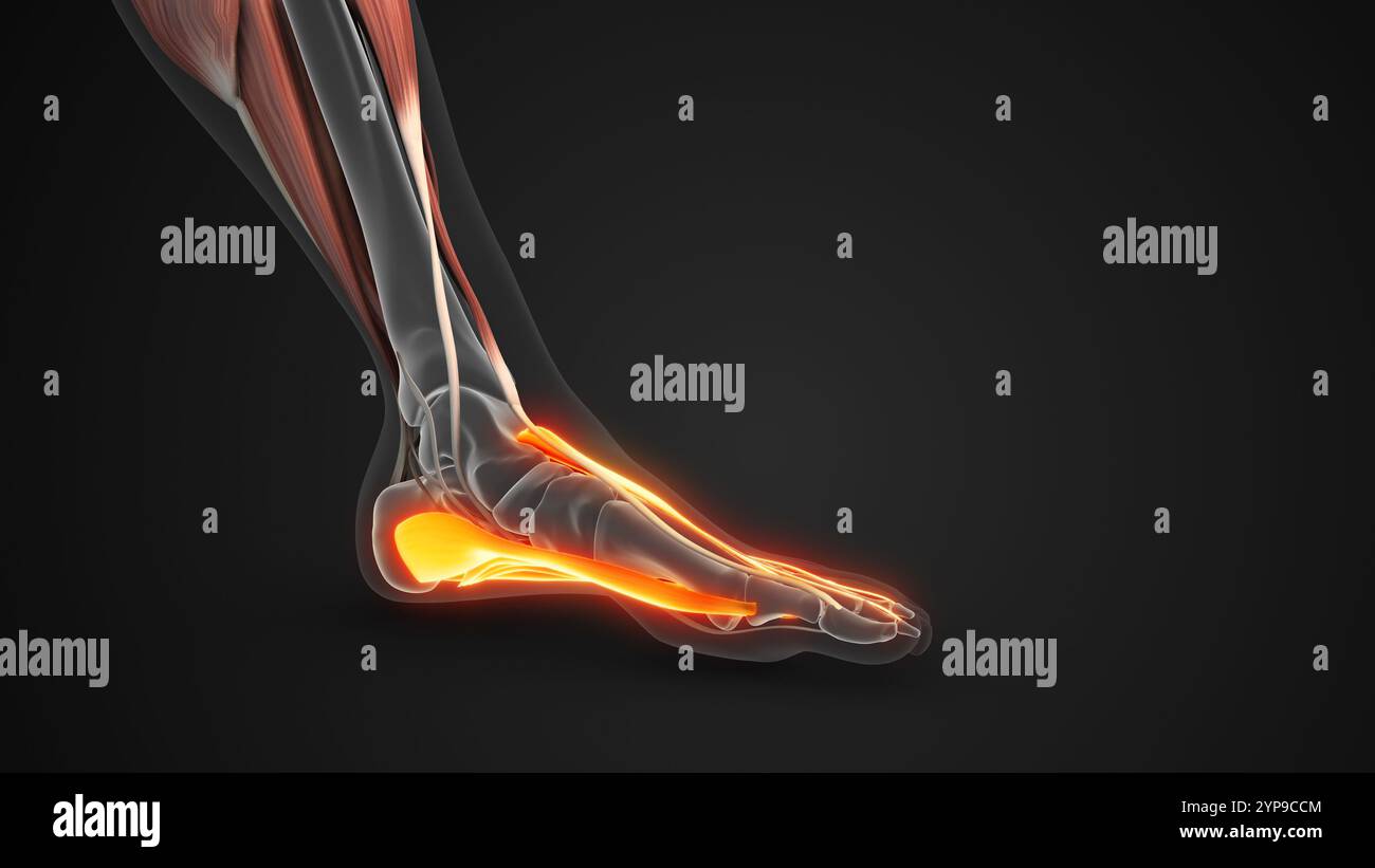 Plantar Fascia Band Supporting Foot Arch Stability Stock Photo - Alamy