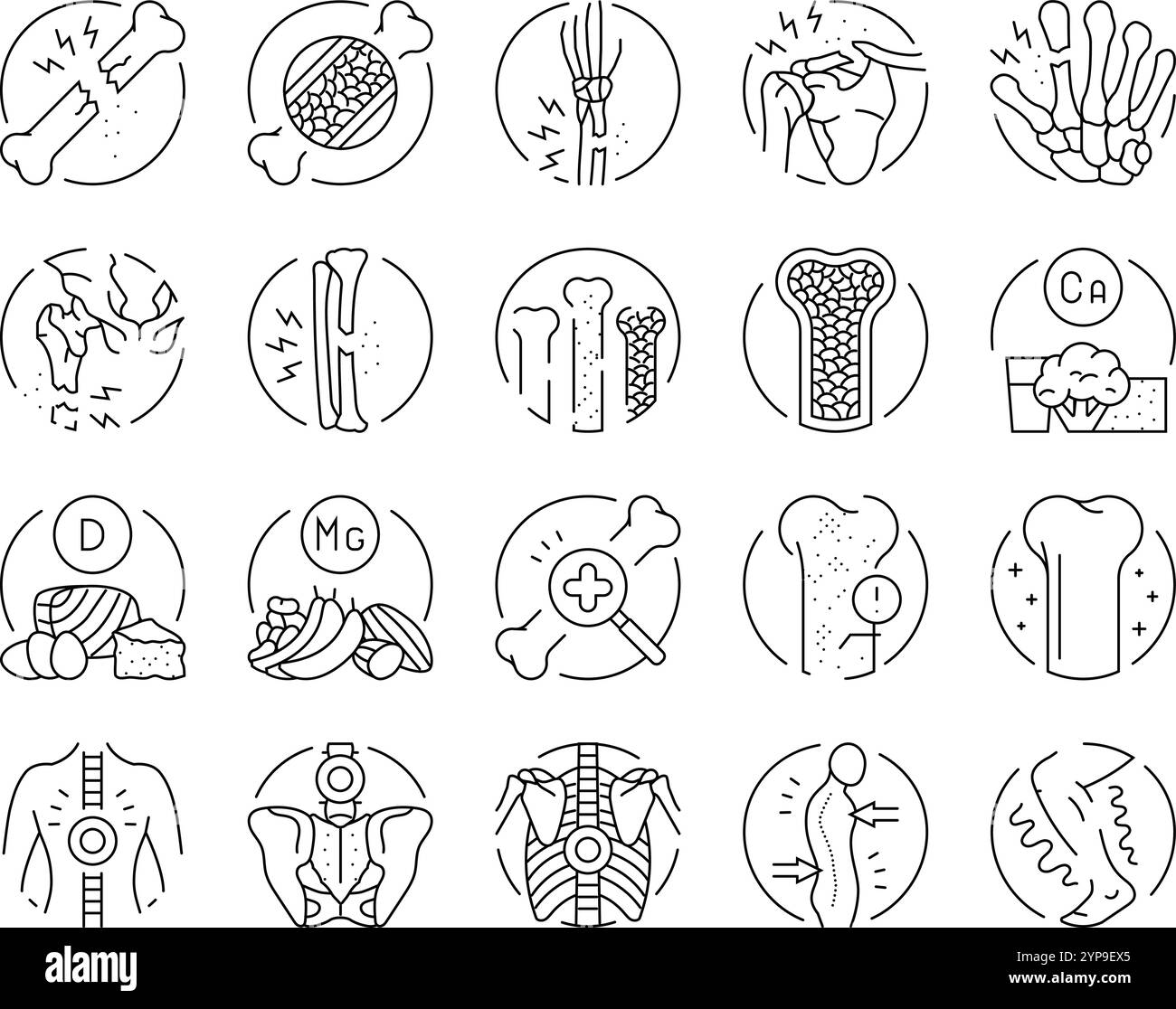 osteoporosis bone pain calcium icons set vector Stock Vector Image ...