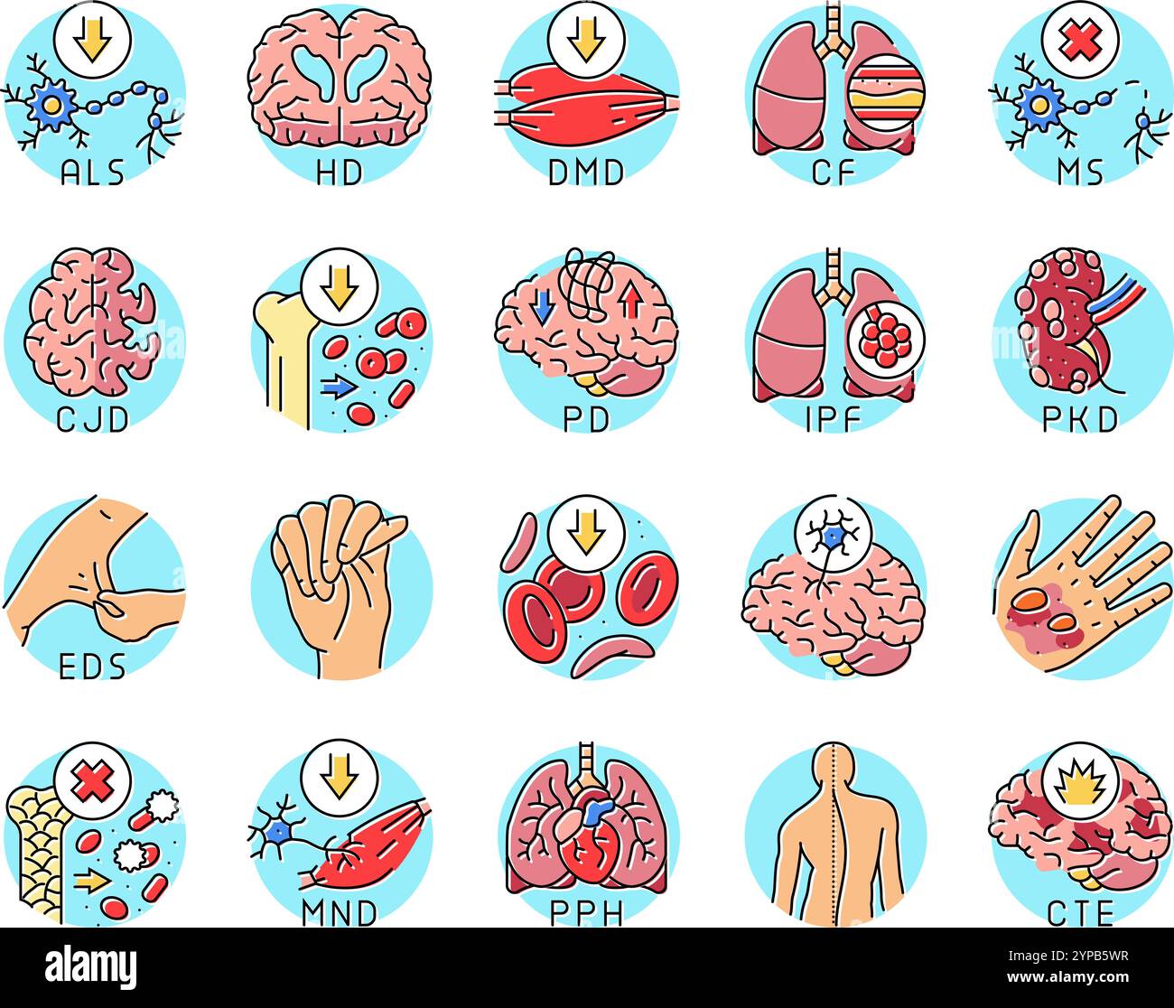 Terminal cancer patient Stock Vector Images - Alamy