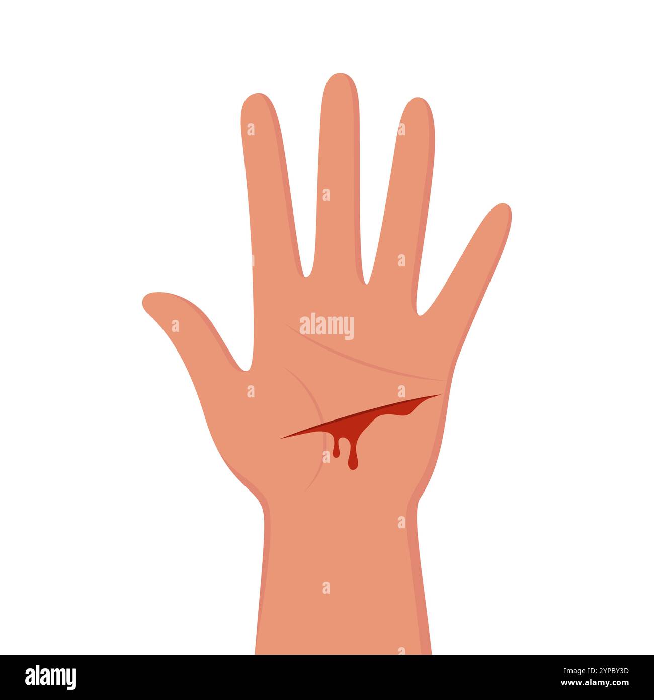 Bleeding cut on the palm, emergency situation. First aid treatment for ...