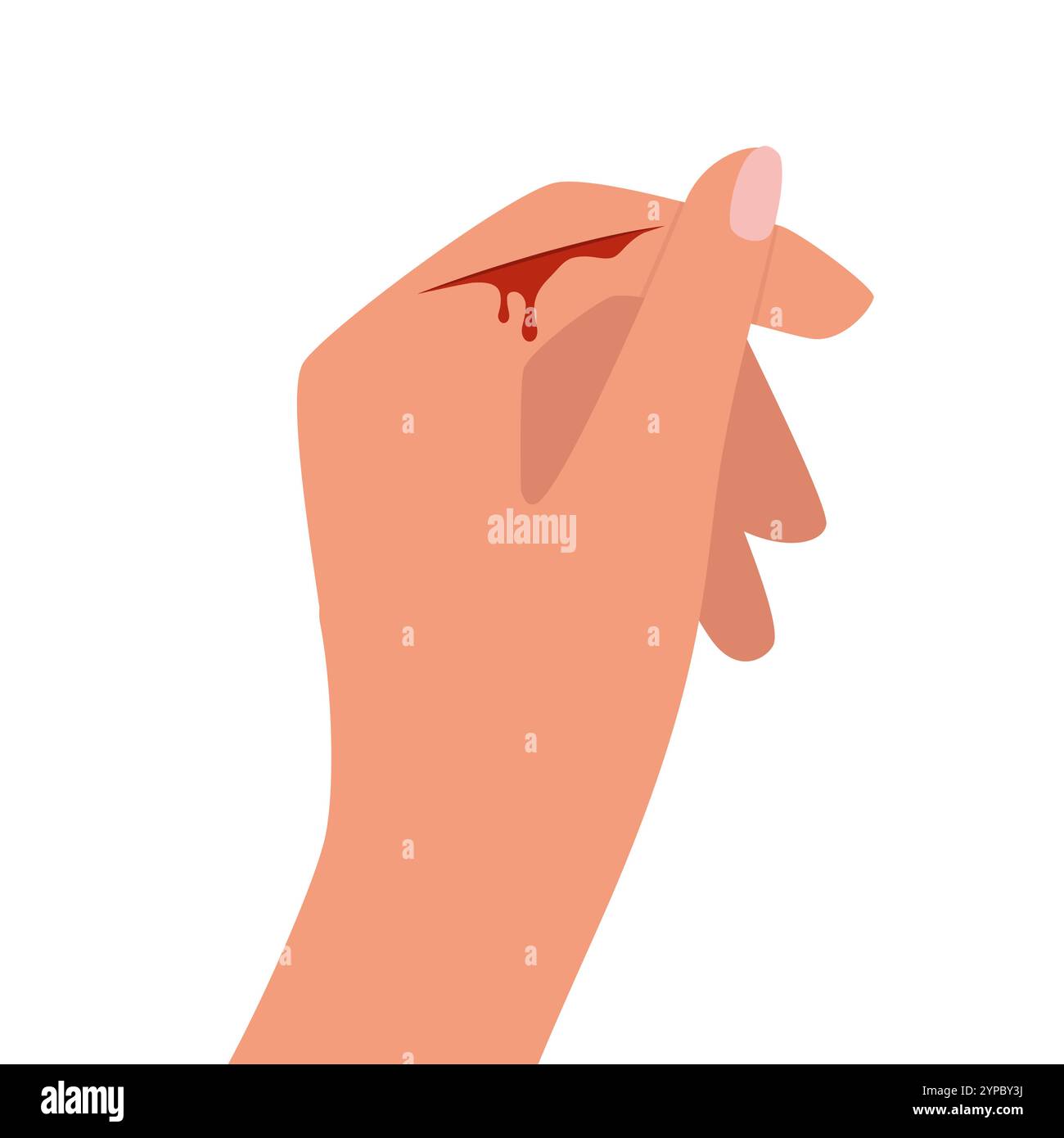 Bleeding cut on the palm, emergency situation. First aid treatment for ...