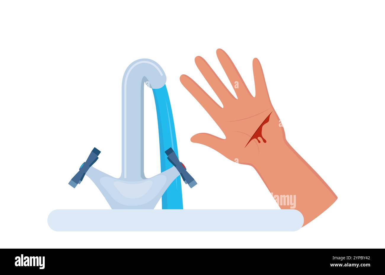 Bleeding cut on the palm, emergency situation. First aid treatment for wound on skin. Trauma ...