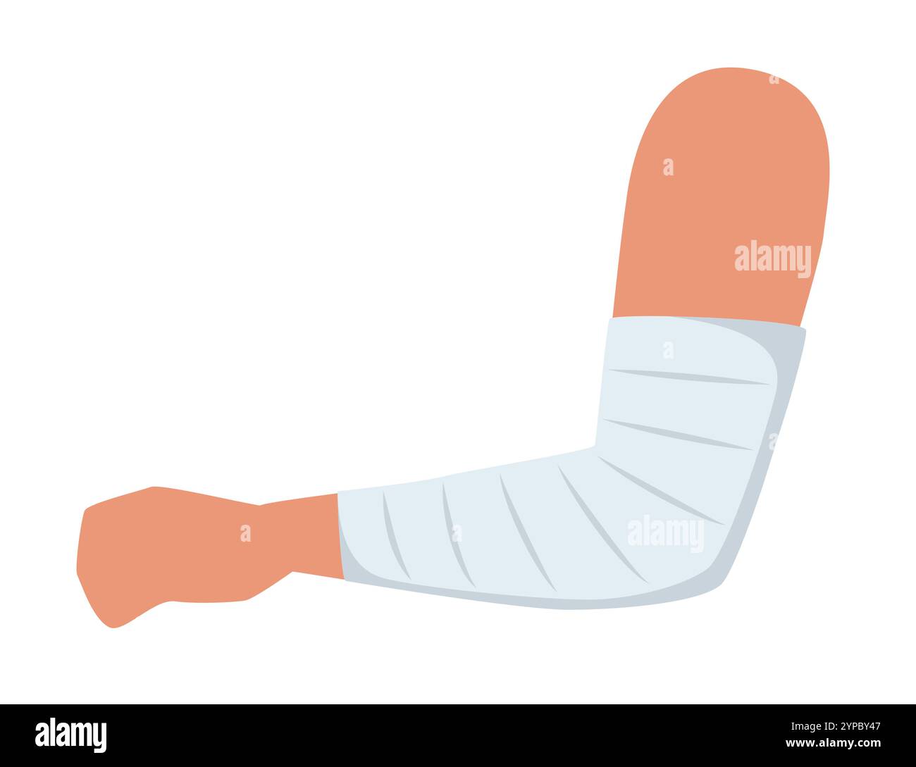 Treatment broken bone first aid Stock Vector Images - Alamy