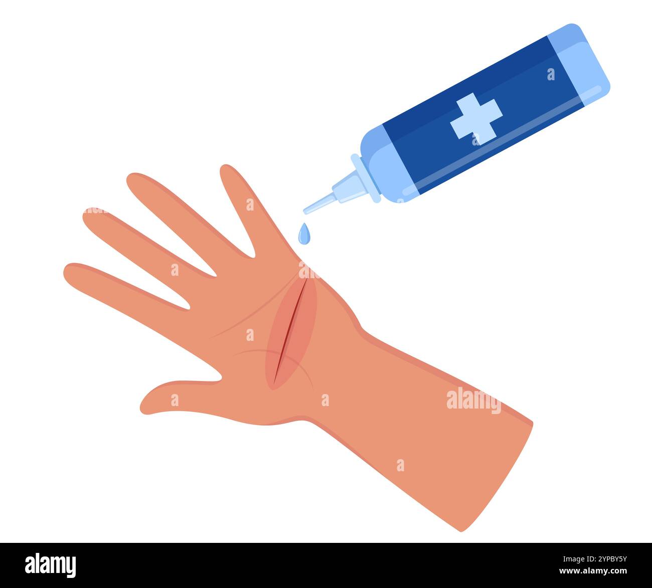 Bleeding cut on the palm, emergency situation. First aid treatment for ...