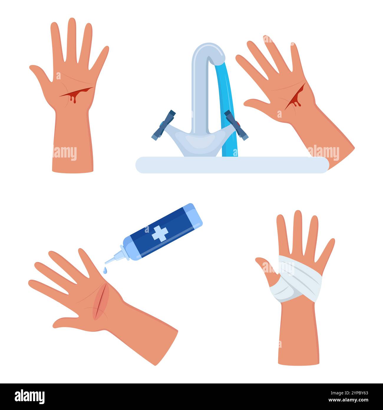 Bleeding cut on the palm, emergency situation. First aid treatment for ...