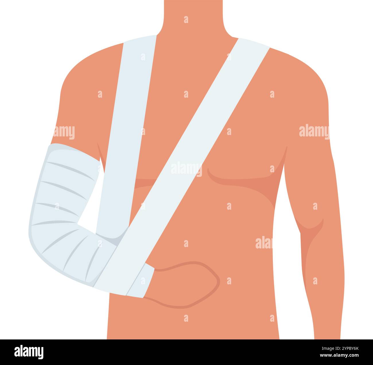 Treatment broken bone first aid Stock Vector Images - Alamy