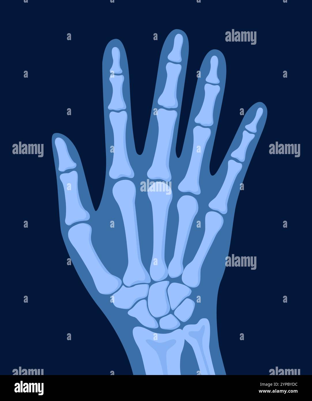Human wrist anatomy xray view hi-res stock photography and images - Alamy