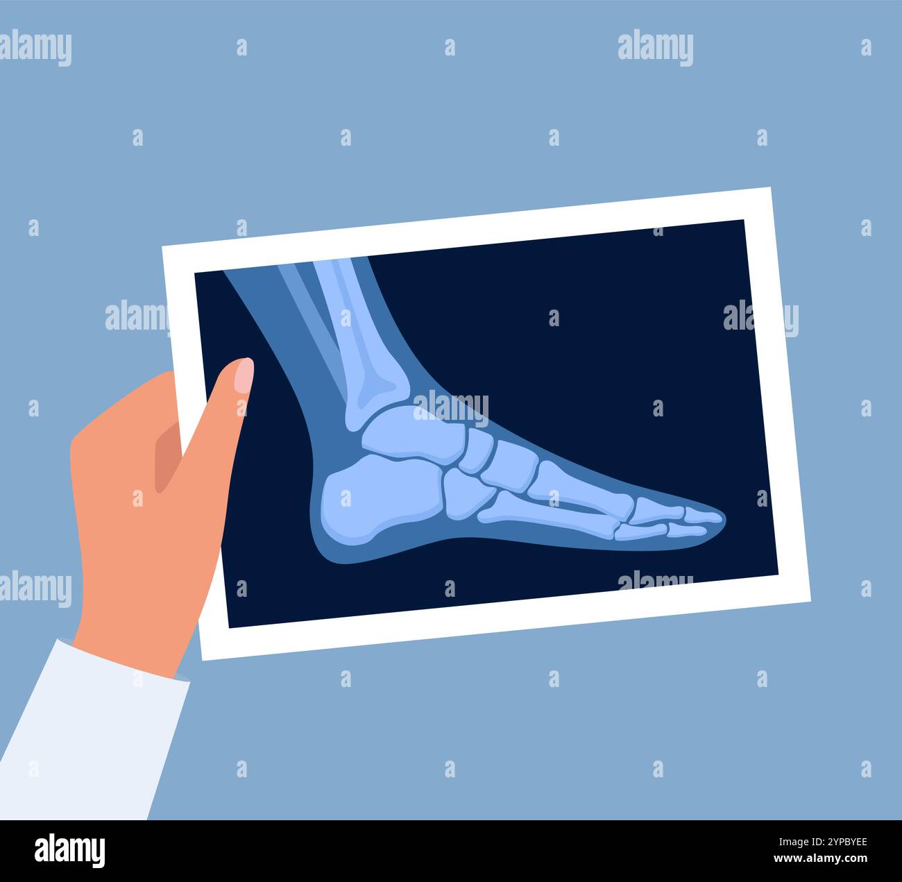 X ray human foot. X-ray picture or radiographic monitor image of ...