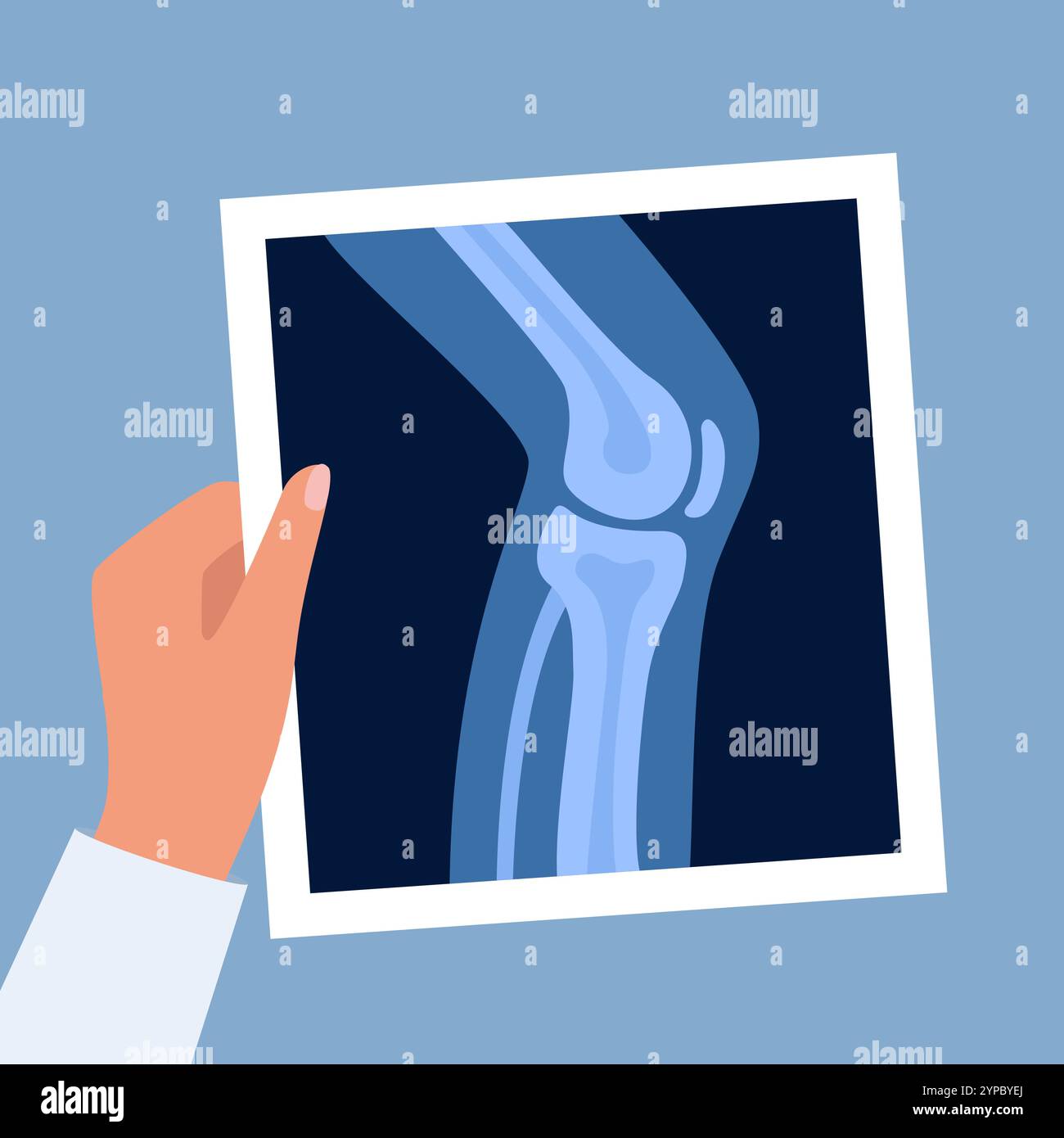 X-ray anatomy of the knee joint and human leg. Roentgen shot in doctors ...