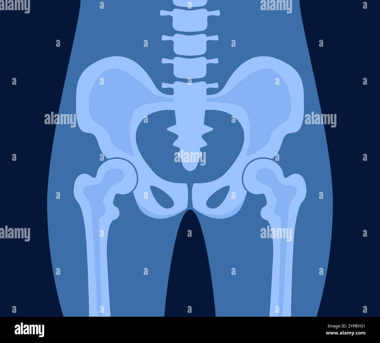 XRay of hip joint pelvis human bones anatomy orthopedic medical ...