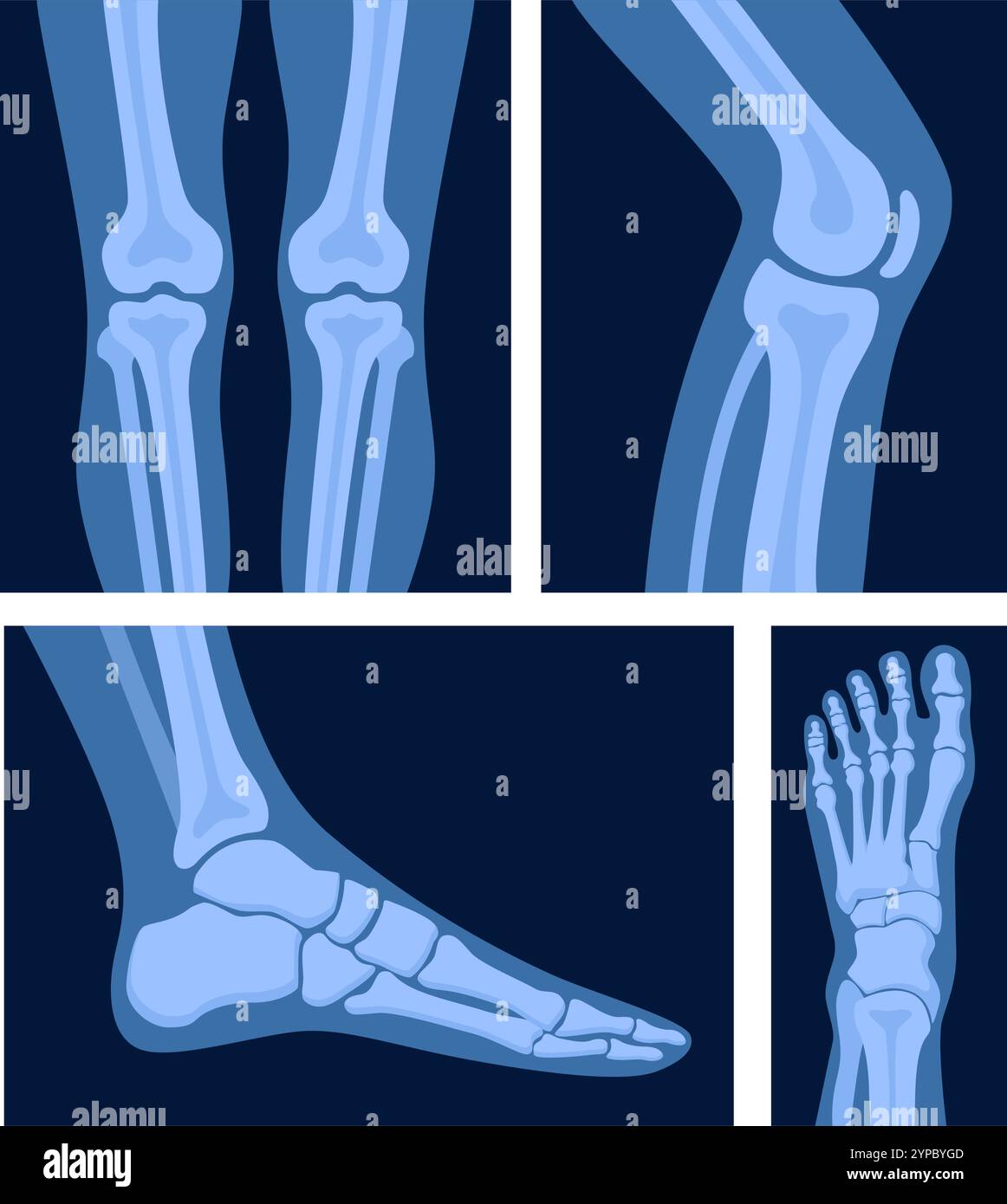 Different x-rays shot of human body part, set. Various x-ray pictures ...