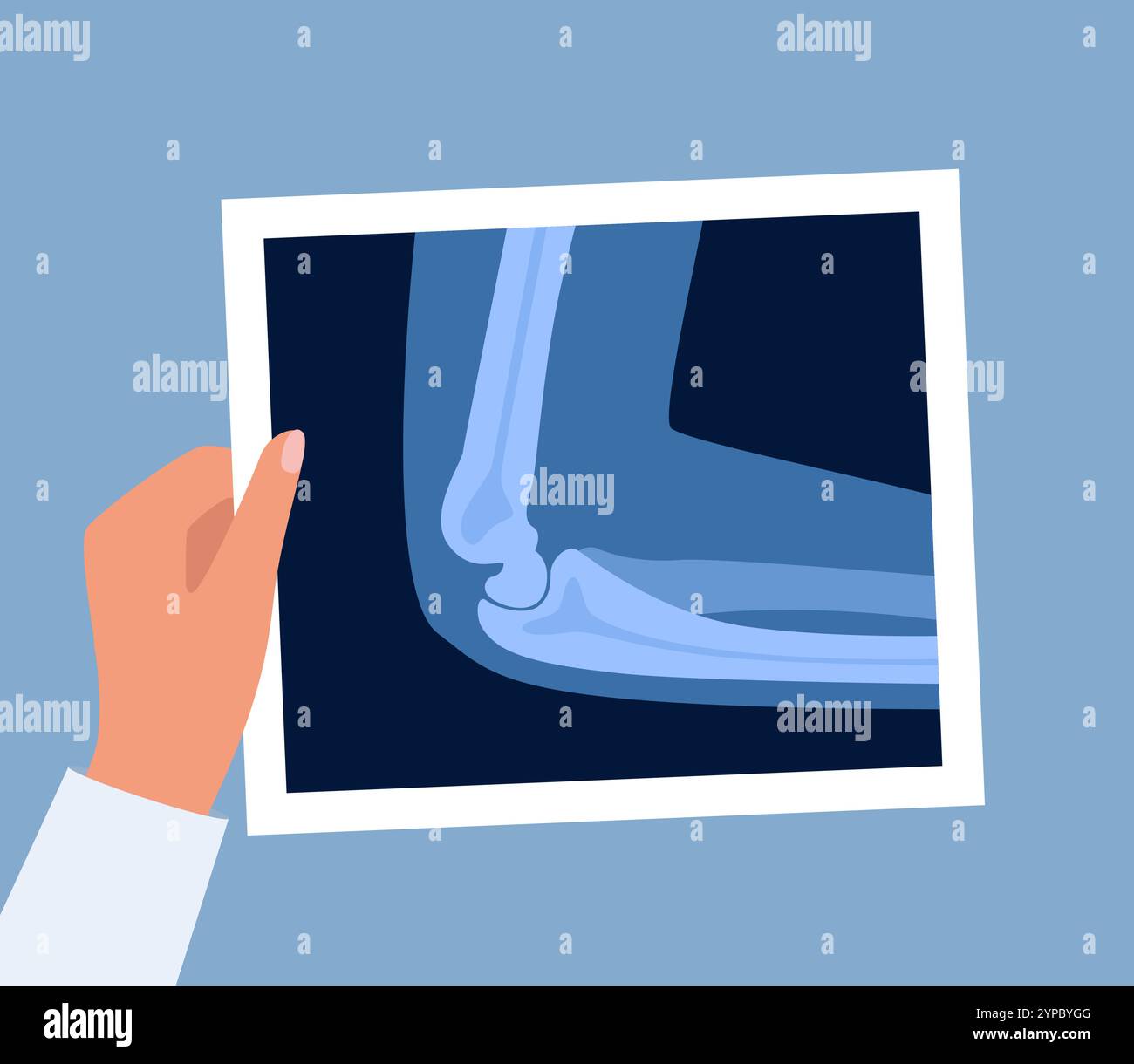 Xray scan of elbow joint. Anatomical structure, care and diagnosis for ...