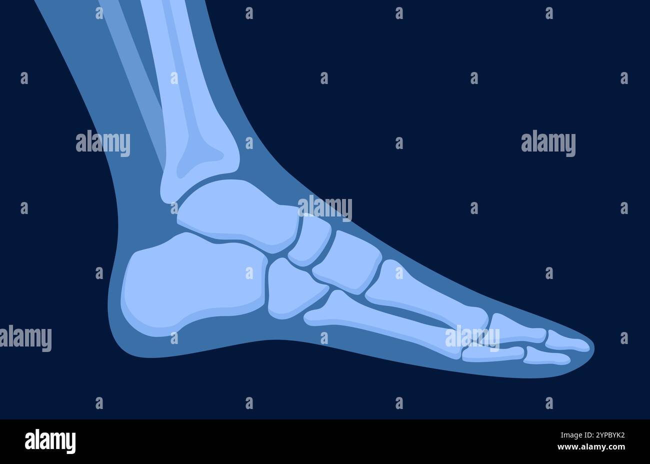 Right foot x ray hi-res stock photography and images - Alamy