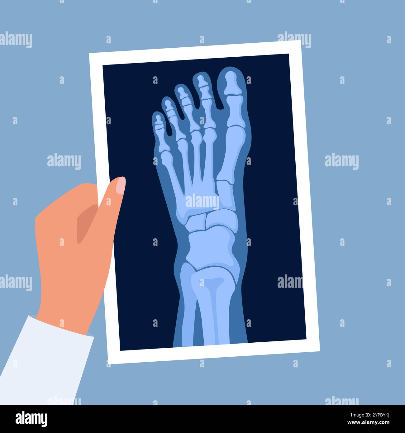 X ray human foot. X-ray picture or radiographic monitor image of ...