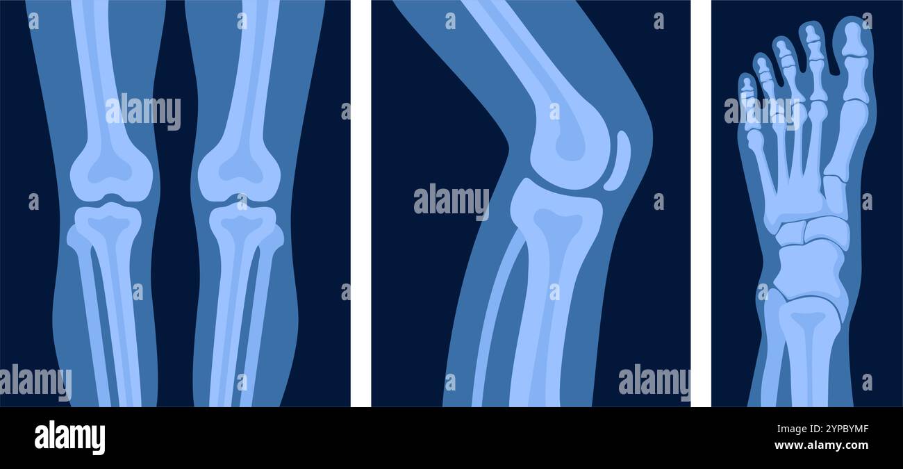 Different x-rays shot of human body part, set. Various x-ray pictures ...