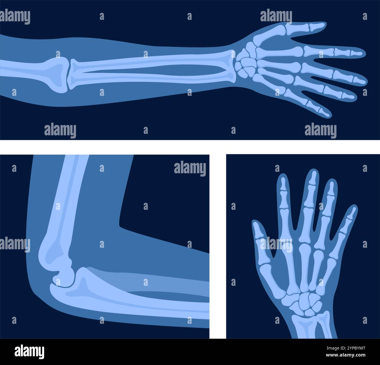 Different x-rays shot of human body part, set. Various x-ray pictures ...