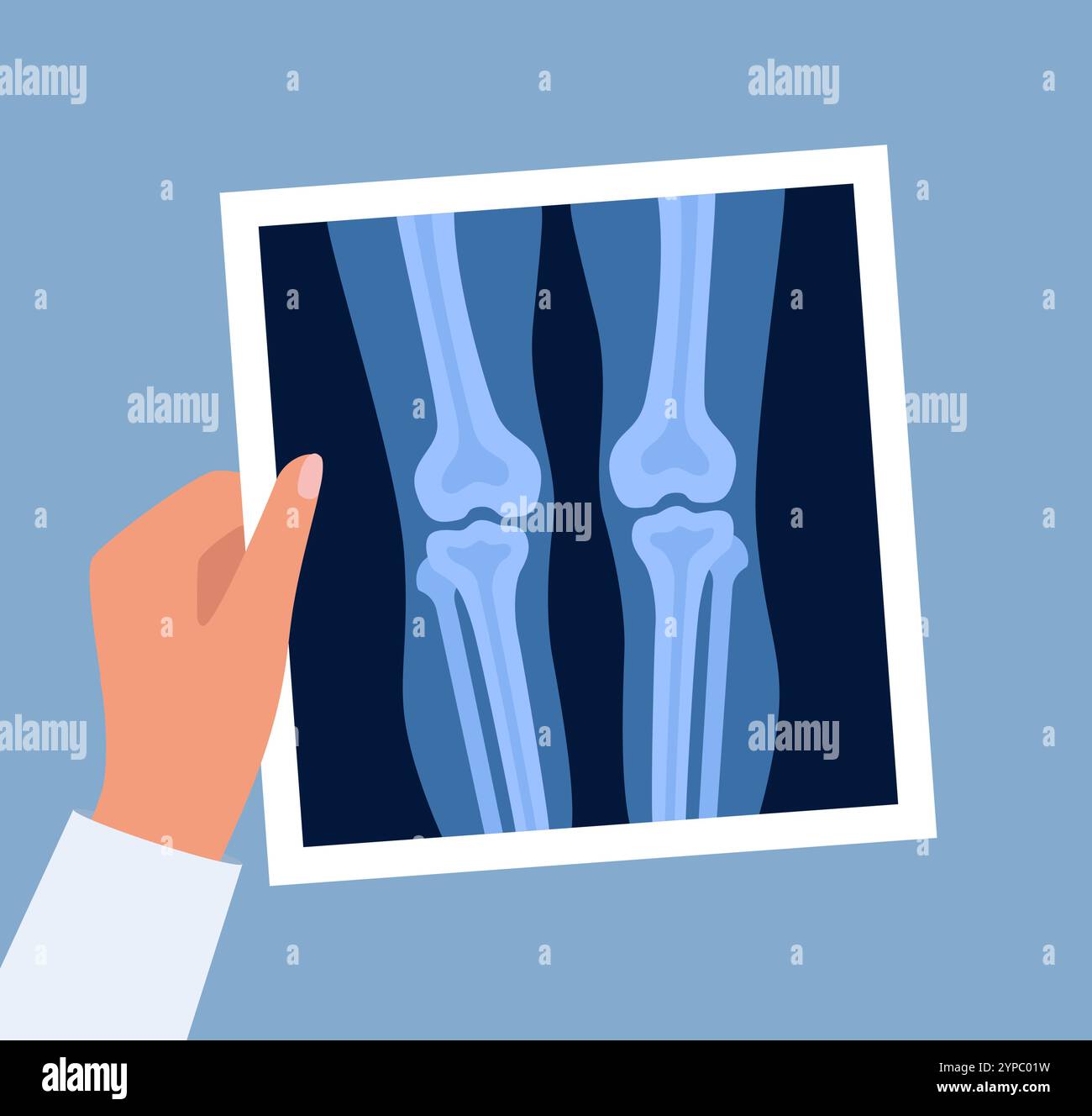 Xray of human knees bones and joints, examination and diagnosis ...