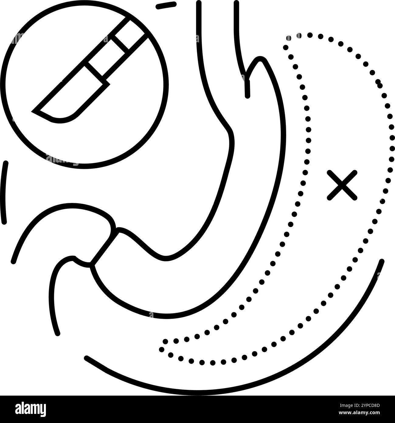 gastrectomy surgery doctor line icon vector illustration Stock Vector ...