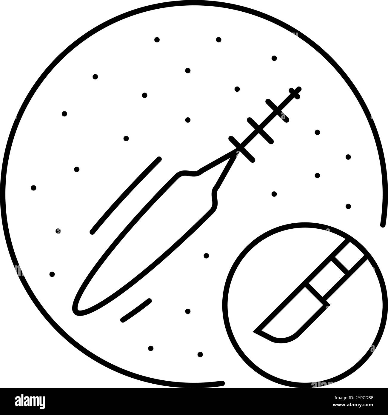 Hysterectomy procedure hi-res stock photography and images - Alamy