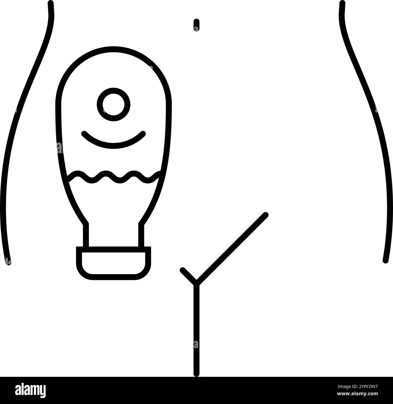 ostomy surgery hospital line icon vector illustration Stock Vector ...