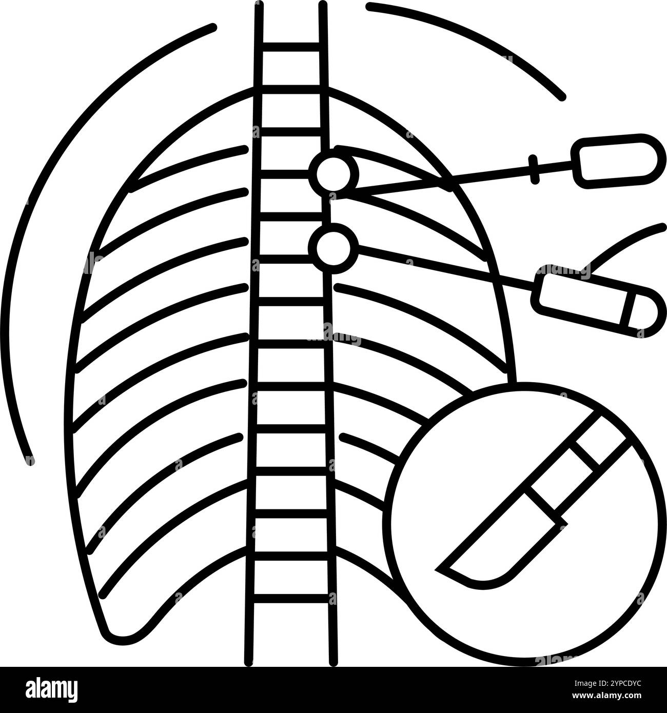 sternotomy surgery hospital line icon vector. sternotomy surgery ...