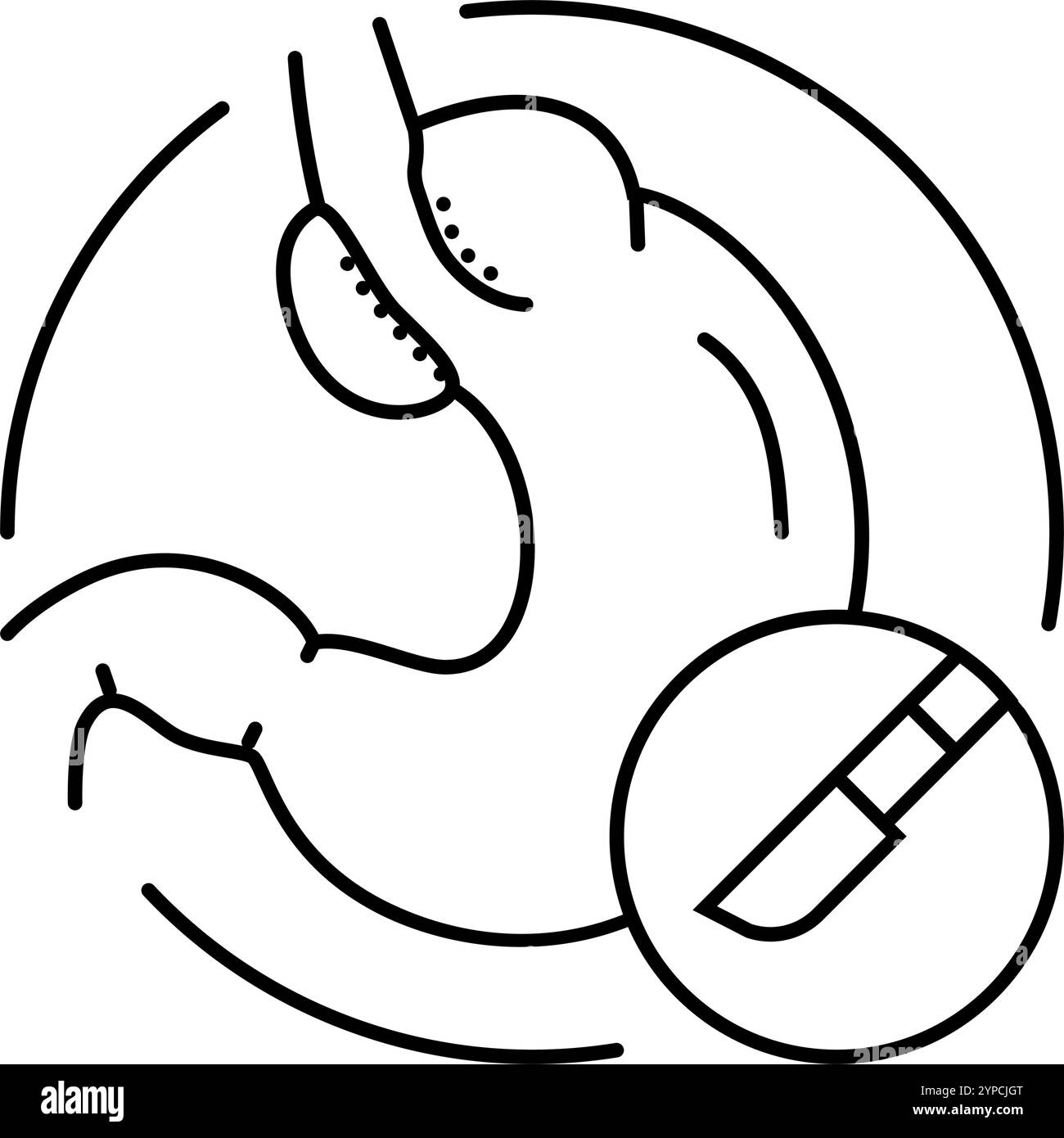 fundoplication surgery line icon vector illustration Stock Vector Image ...