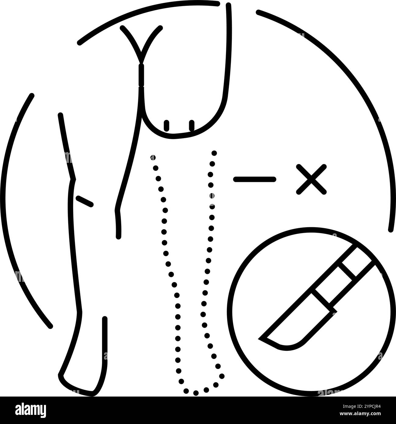 limb amputation surgery line icon vector illustration Stock Vector ...