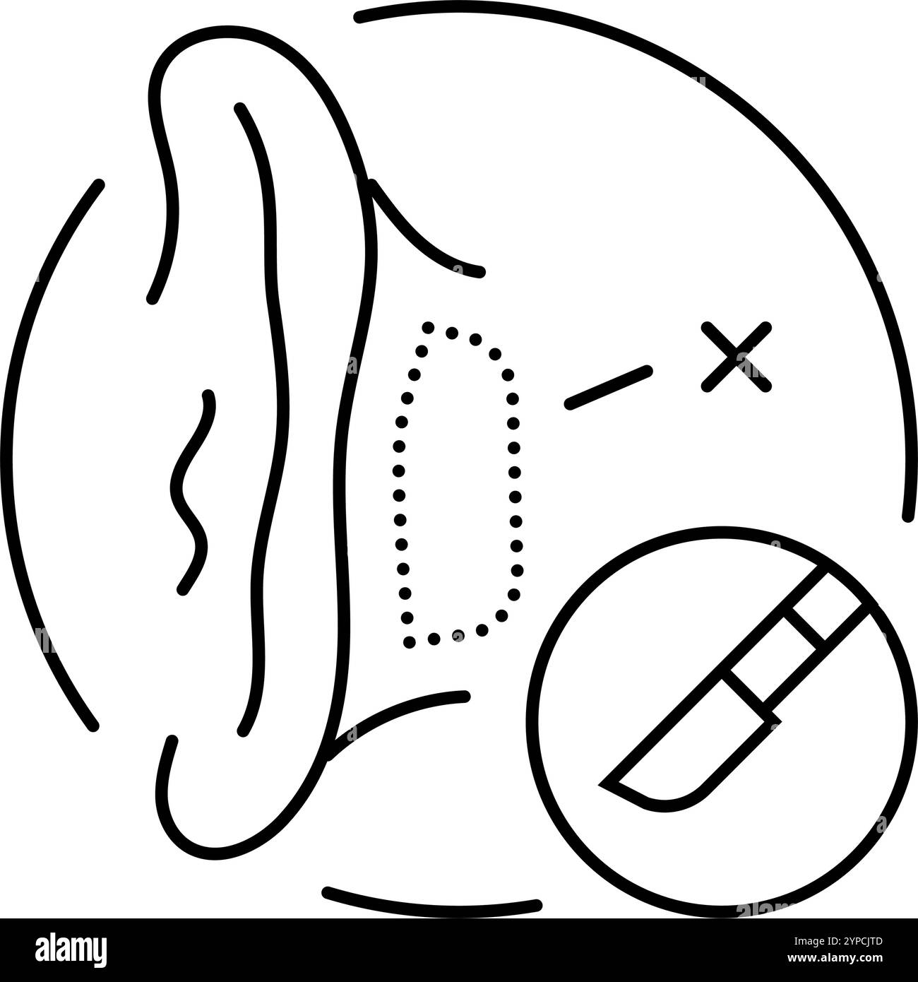 otoplasty surgery line icon vector illustration Stock Vector Image & Art - Alamy