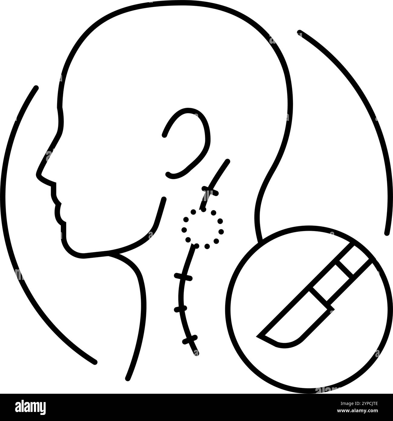 lymph node dissection surgery line icon vector illustration Stock ...