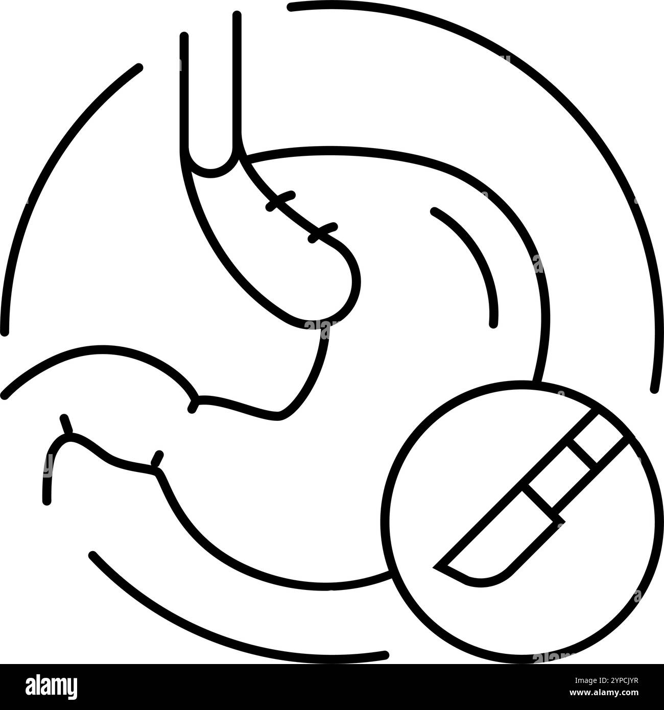 nissen fundoplication surgery line icon vector illustration Stock ...