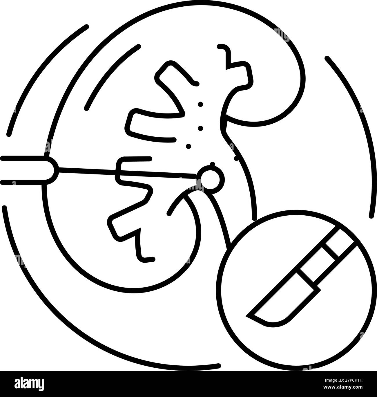 kidney transplant surgery line icon vector illustration Stock Vector ...