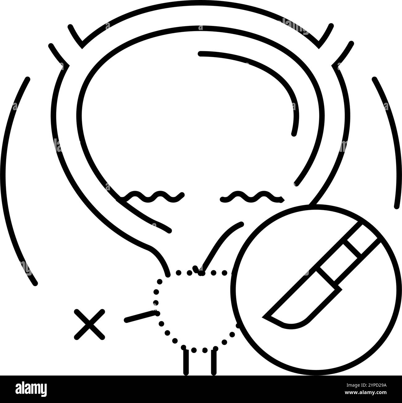 prostatectomy urology line icon vector illustration Stock Vector Image ...