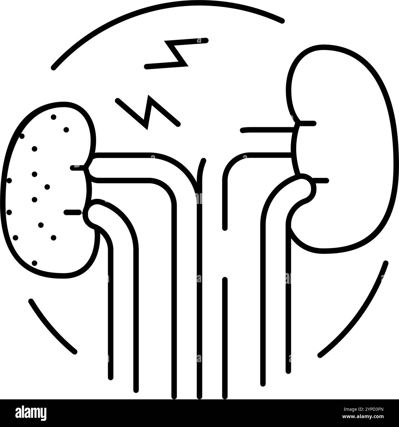 nephrectomy urology line icon vector illustration Stock Vector Image ...