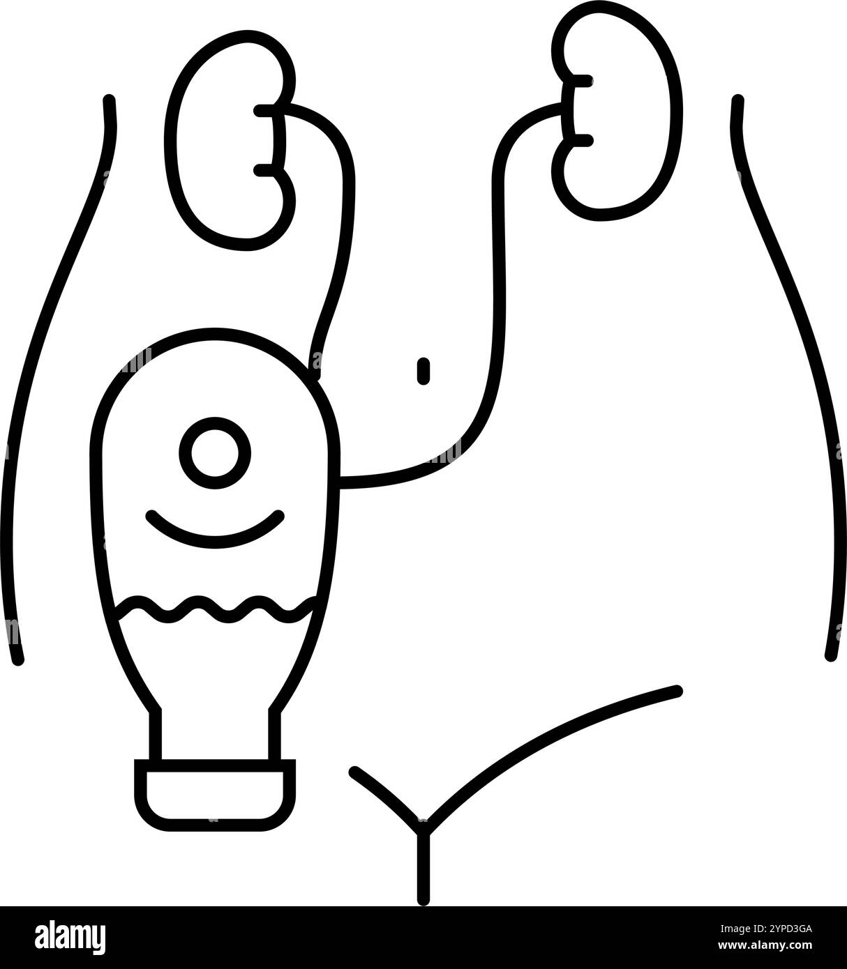 hydronephrosis urology line icon vector illustration Stock Vector Image ...