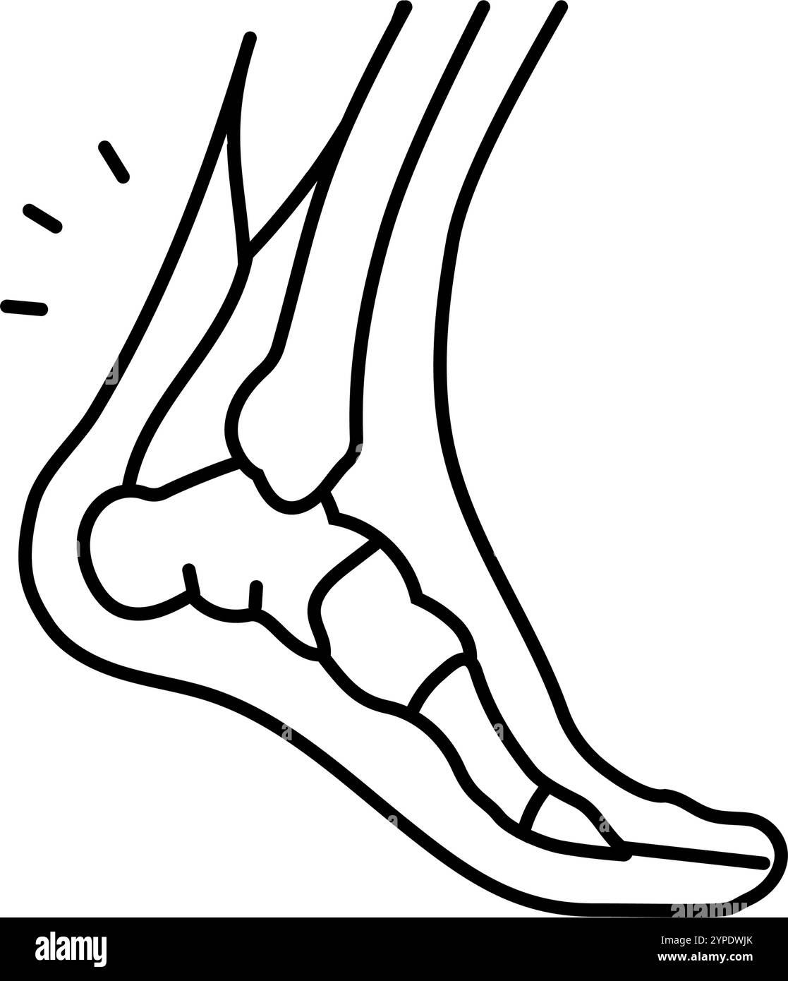 sprain household injury accident line icon vector illustration Stock ...