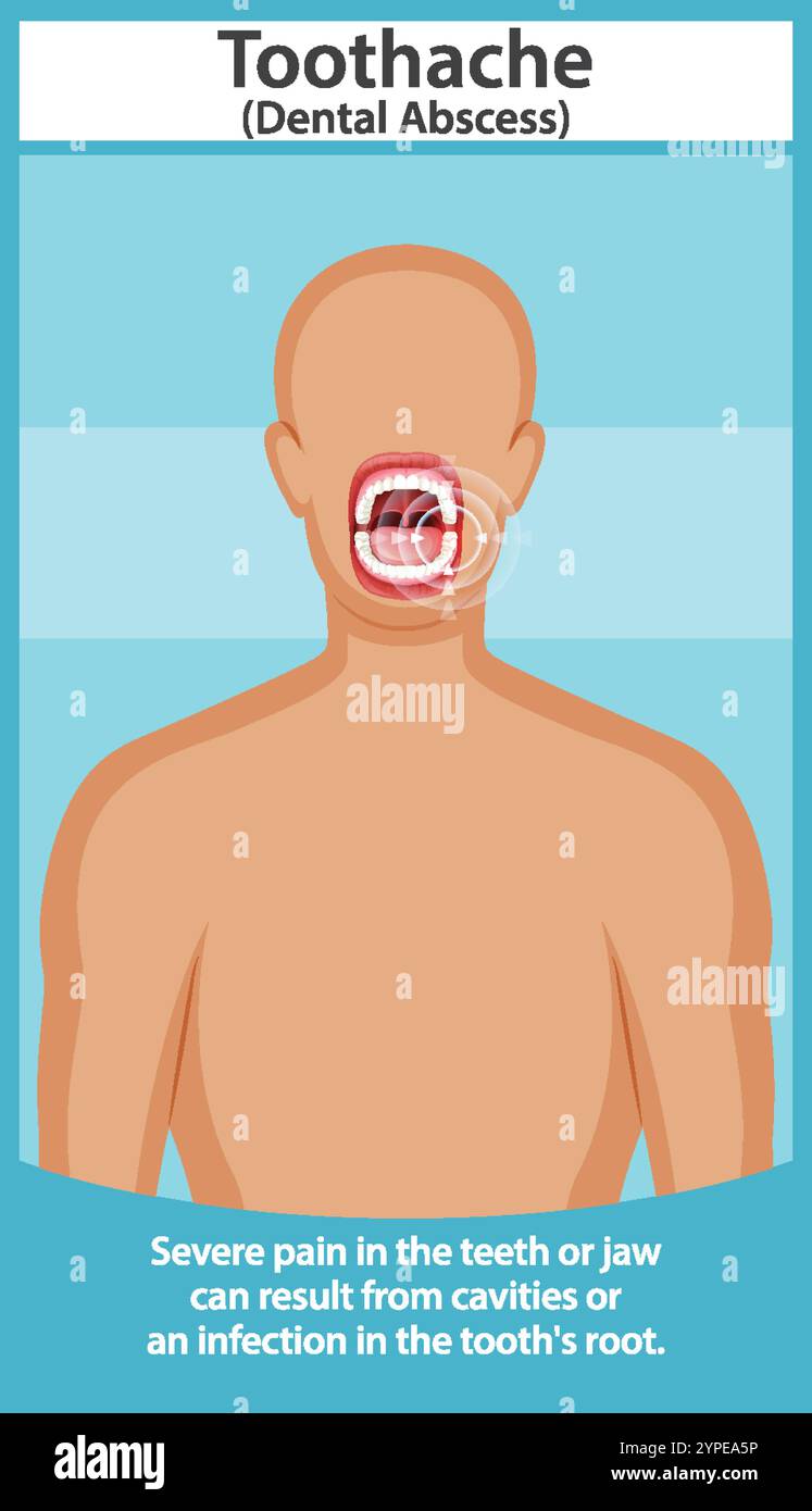Illustration of toothache causes and symptoms Stock Vector Image & Art ...
