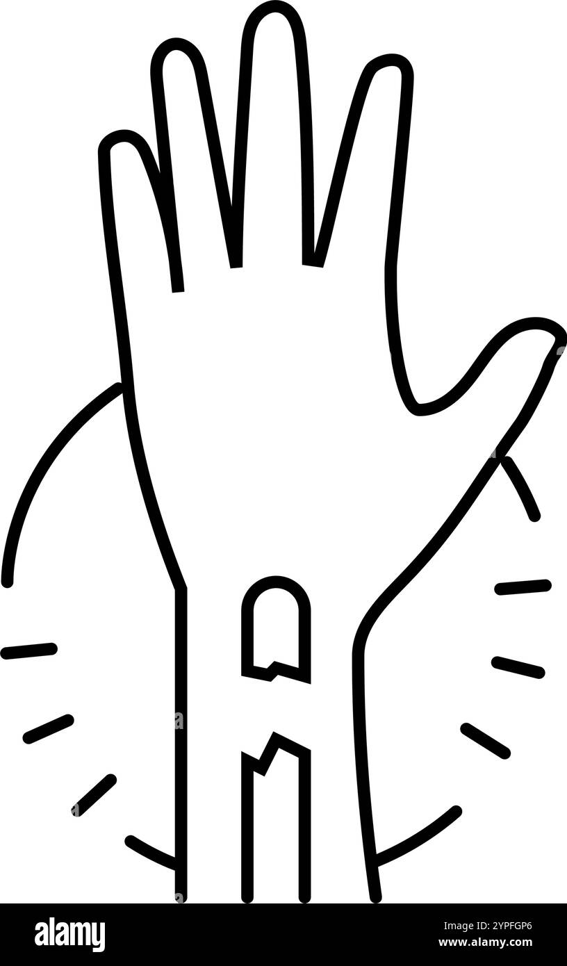 Fracture arm x ray Black and White Stock Photos & Images - Alamy