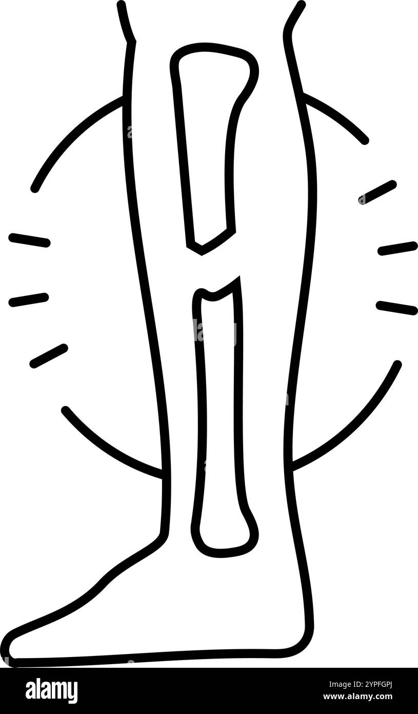 broken leg fracture injury line icon vector illustration Stock Vector ...