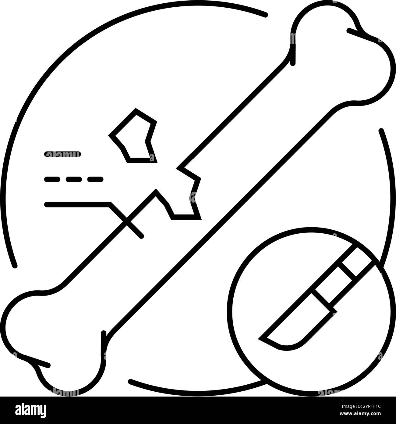 orthopedic surgery fracture injury line icon vector illustration Stock ...