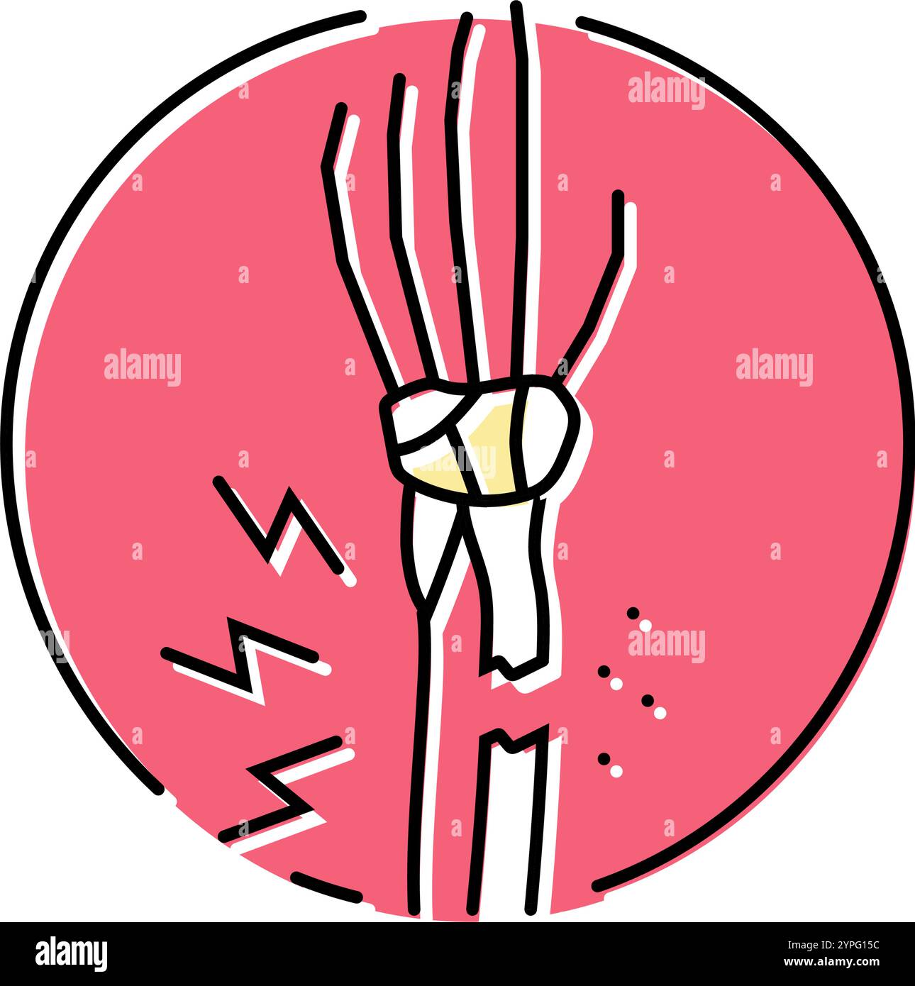 fracture forearm bones osteoporosis color icon vector illustration ...