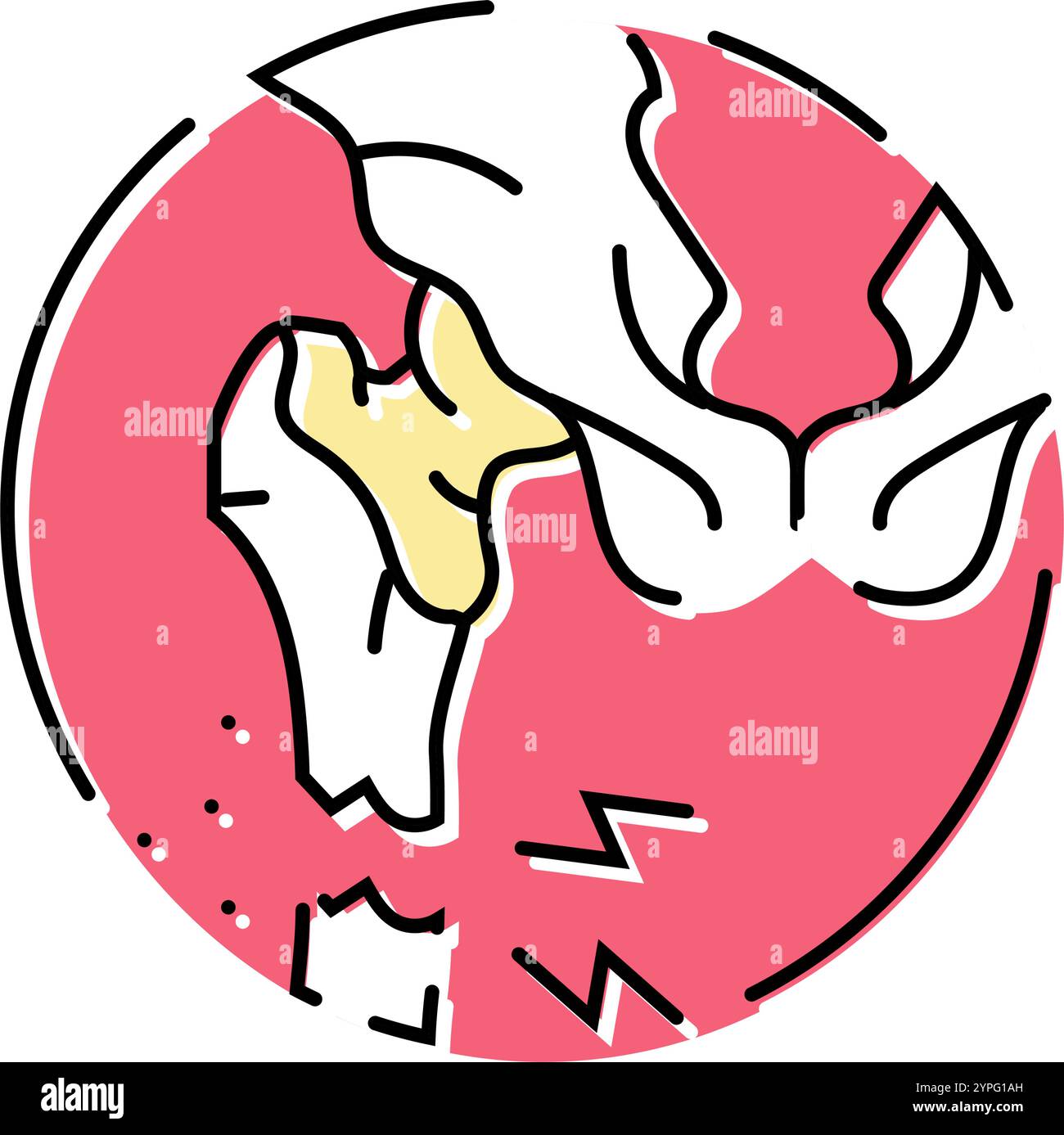 hip fracture osteoporosis bone color icon vector illustration Stock ...