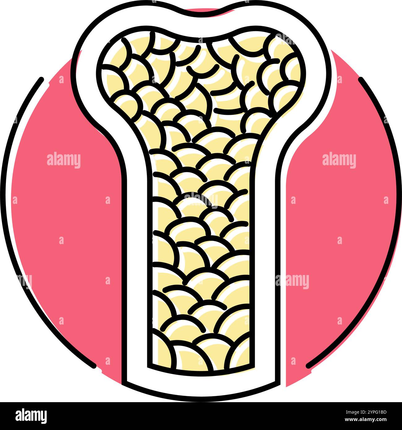 porous bone osteoporosis color icon vector illustration Stock Vector ...