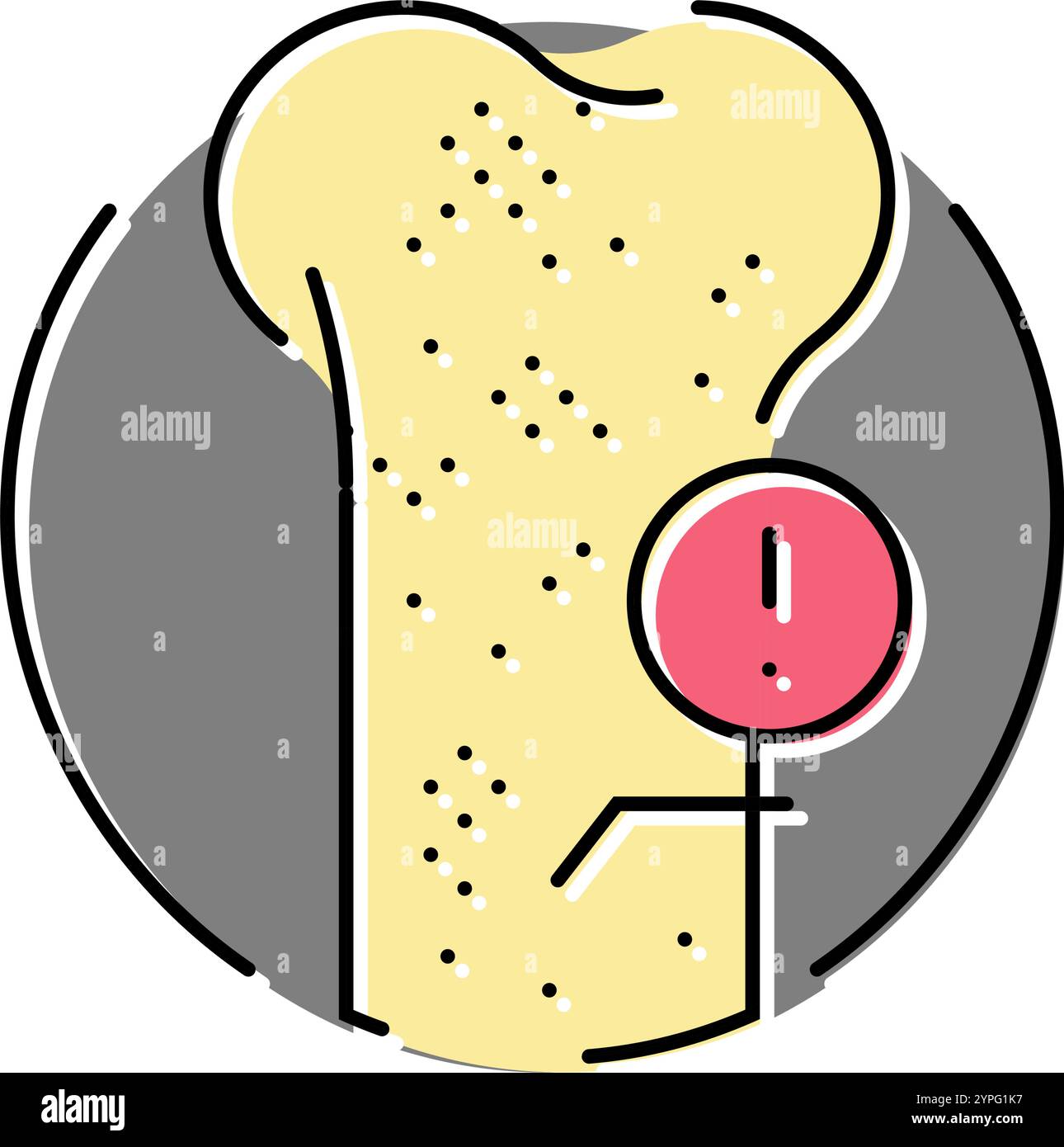 severe osteoporosis bone color icon vector illustration Stock Vector ...