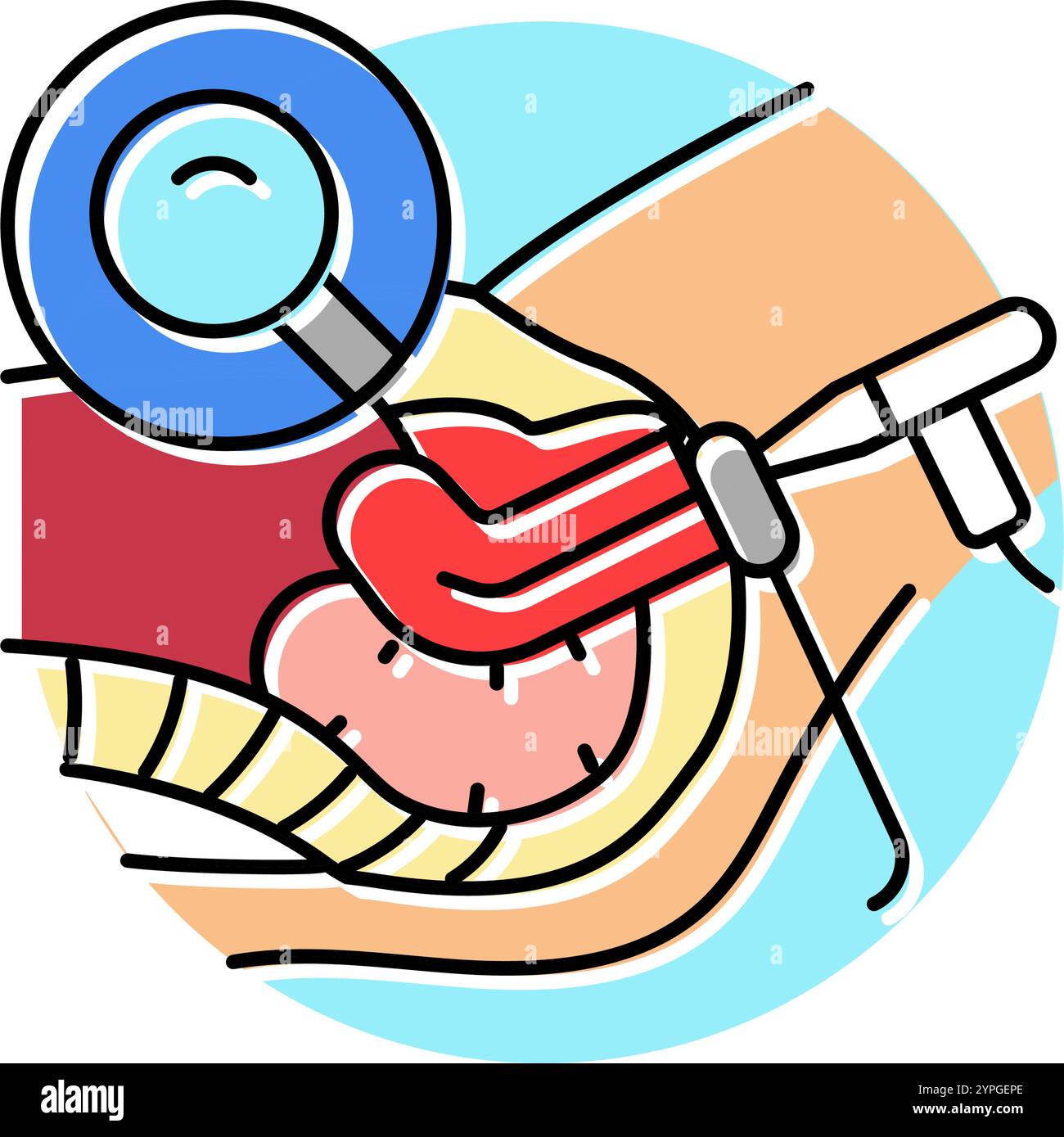 Hysteroscopy hi-res stock photography and images - Alamy