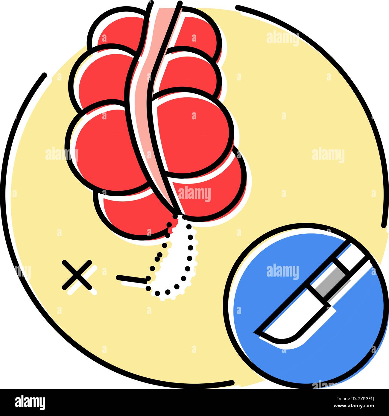 appendectomy surgery doctor color icon vector illustration Stock Vector ...
