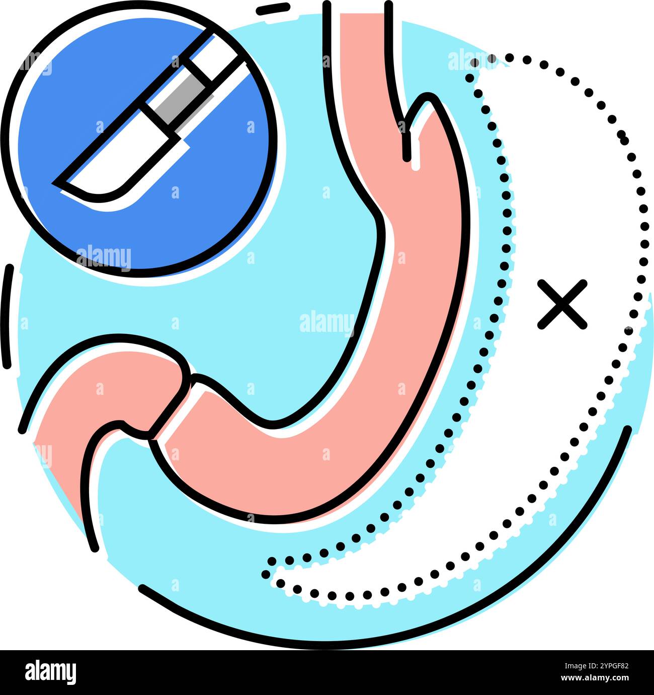 gastrectomy surgery doctor color icon vector illustration Stock Vector ...