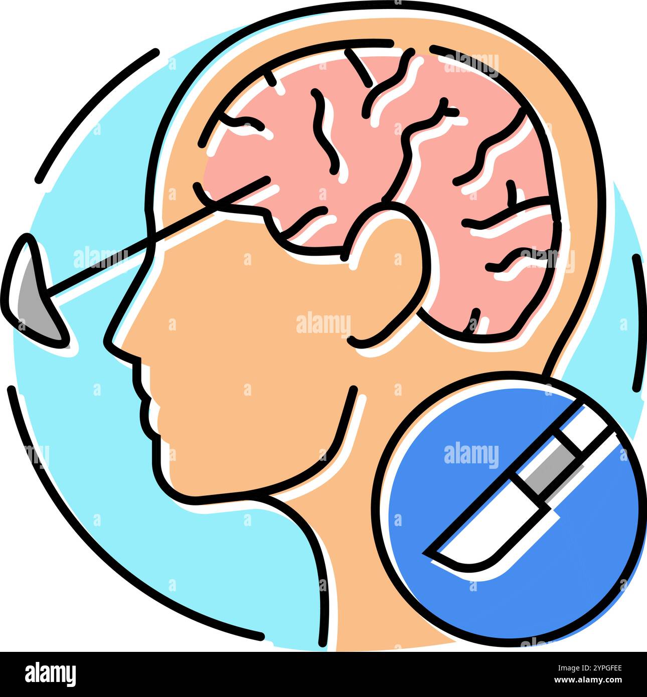 Lobotomy surgery hi-res stock photography and images - Alamy