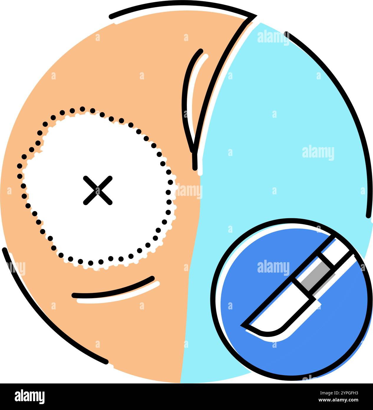 mastectomy surgery hospital color icon vector illustration Stock Vector ...