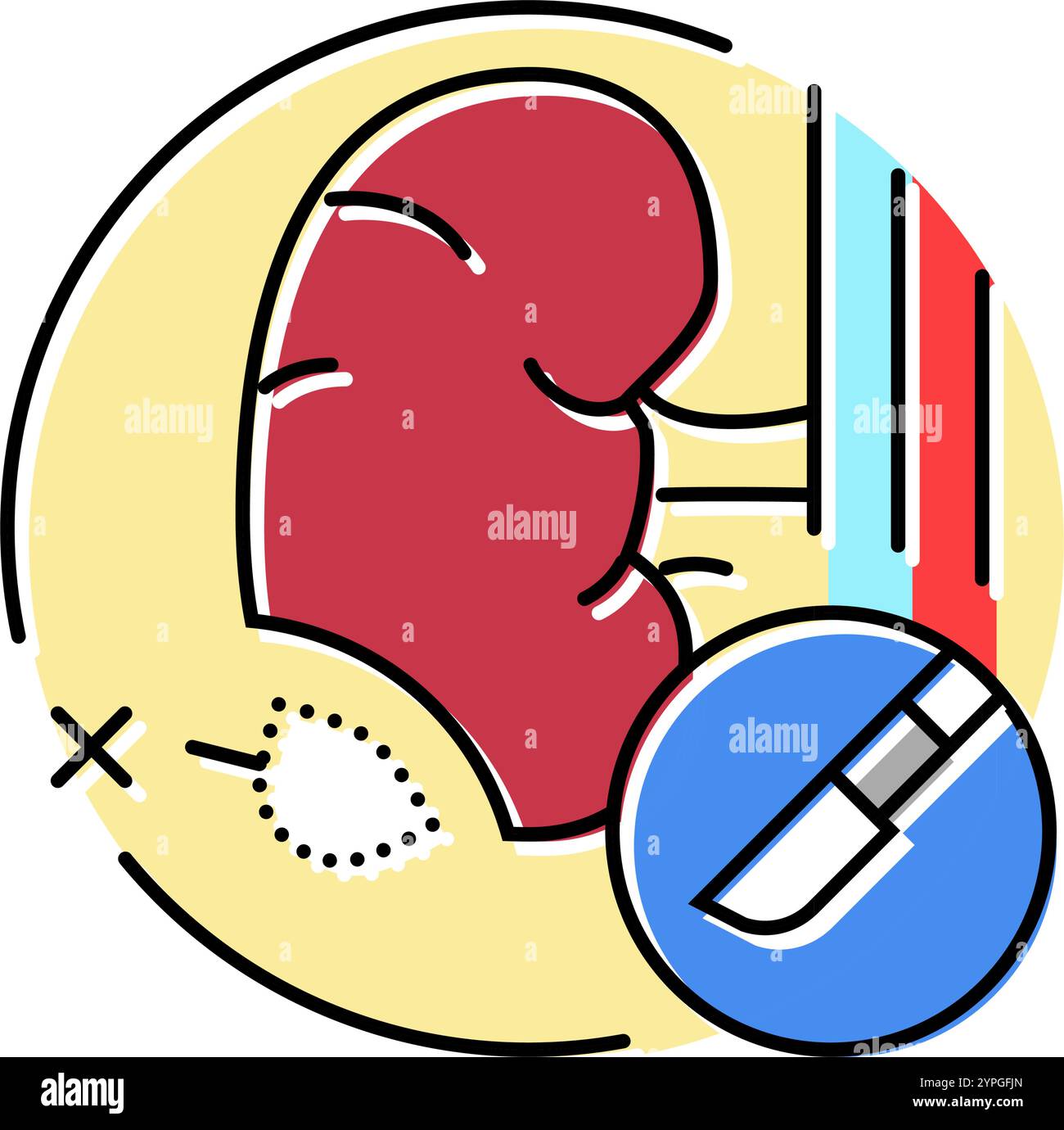 nephrectomy surgery hospital color icon vector illustration Stock ...